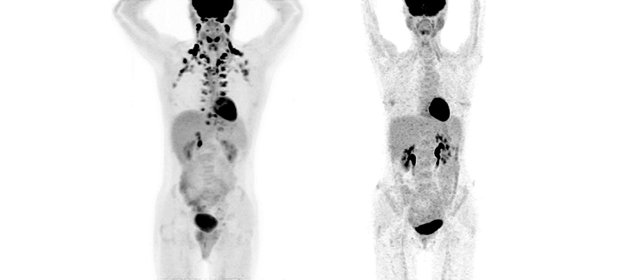 CTSA Program-Supported Researchers May Turn Brown Fat into an Ally ...