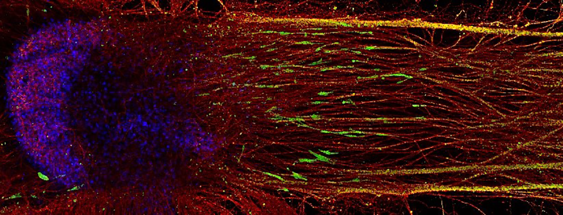 Small Business Awards Propel the Development of a “One-of-a-Kind ...